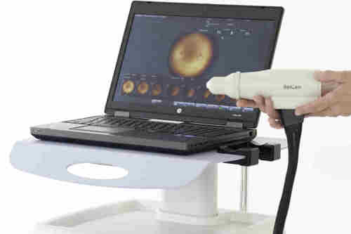 Screening of infants for ocular abnormalities - eyeonoptics