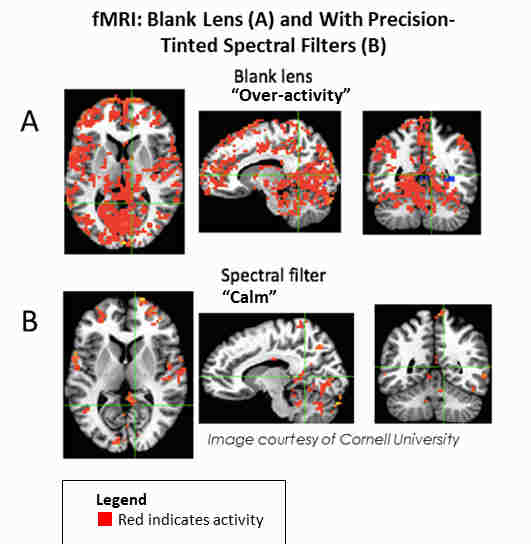 The Irlen Institute: the case for Irlen - eyeonoptics