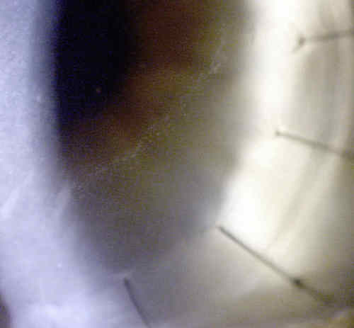 Corneal transplant rejection: principles and clinical management - nzoptics