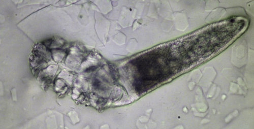 Antiparasitic efficacy of eyelid cleansers for Demodex blepharitis ...