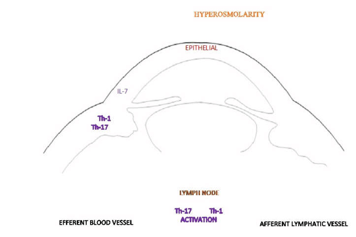 The role of inflammation in dry eye - eyeonoptics