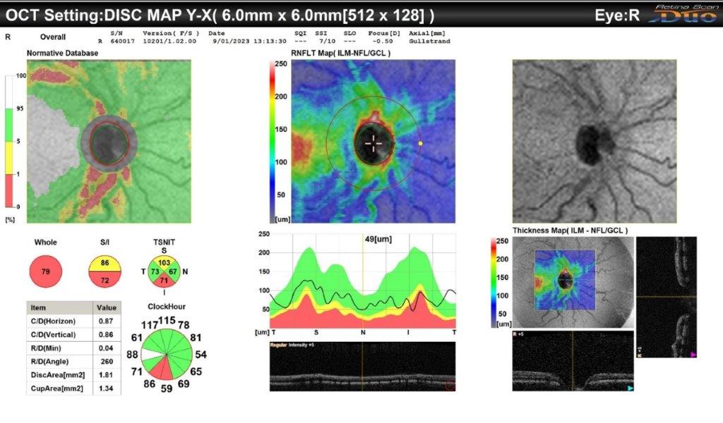 Beware the cap wearer!