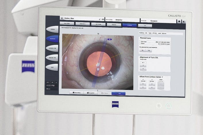 Advanced biometry webinars - nzoptics