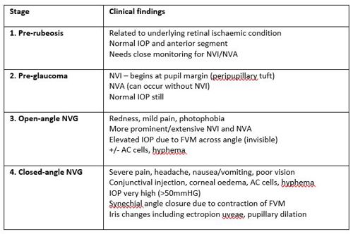 Neovascular glaucoma - nzoptics