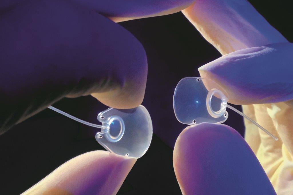 Molteno sold to Nova Eye Medical - eyeonoptics