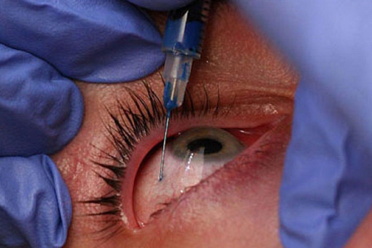 Retina research review - eyeonoptics