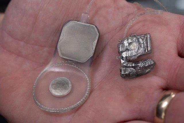 Bionic eye looks to human trials - eyeonoptics