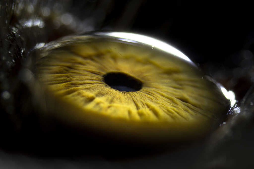 Corneal hysteresis linked to glaucoma progression - nzoptics