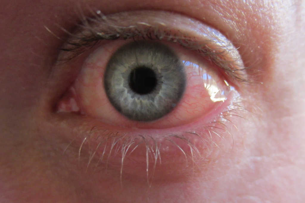 The OSL eye for an eye study - nzoptics