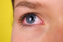 Reproxalap’s DED mission - nzoptics