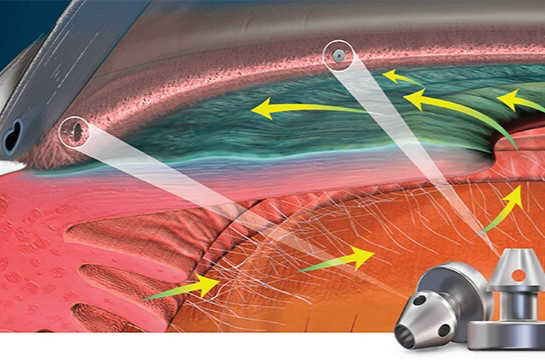 MIGS: it’s just business! - nzoptics