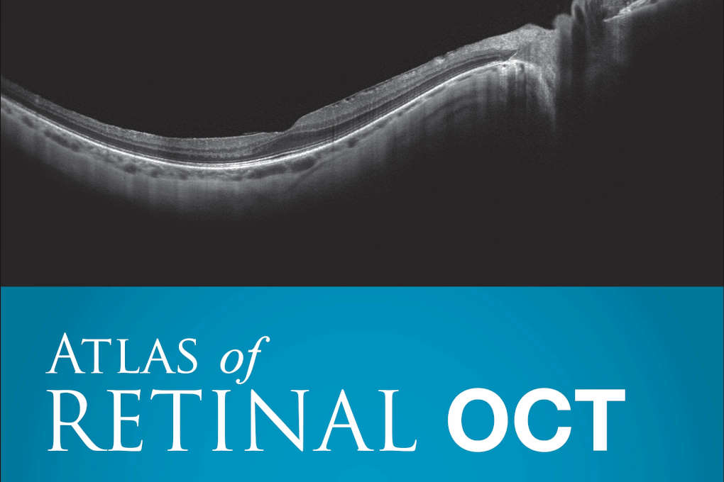 Book review – Atlas of Retinal OCT, 1st edition
