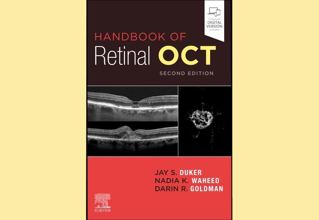 BOOK REVIEW: Handbook of Retinal OCT (second edition) by Jay Duker ...