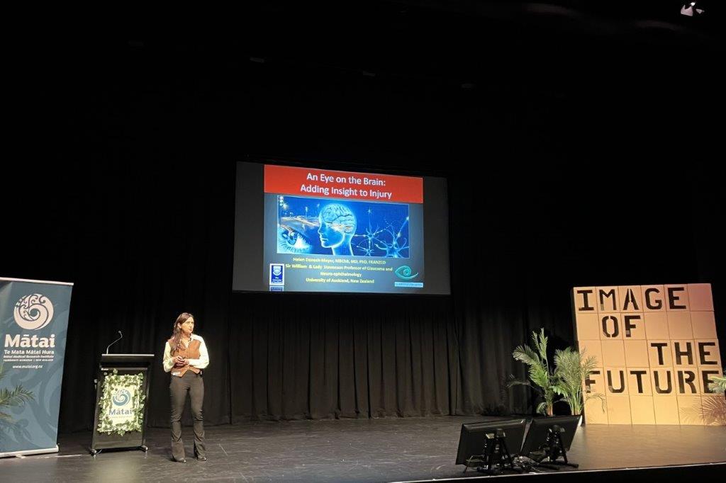 Sarcoidosis and the eye