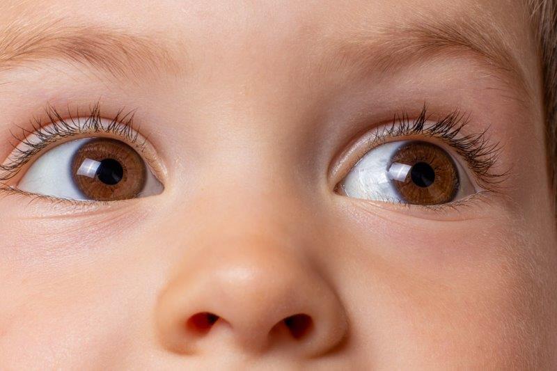 IOLs reduce aphakic kids’ glaucoma risk