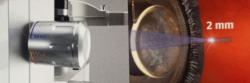 Ellex: introducing Tango Reflex Neo