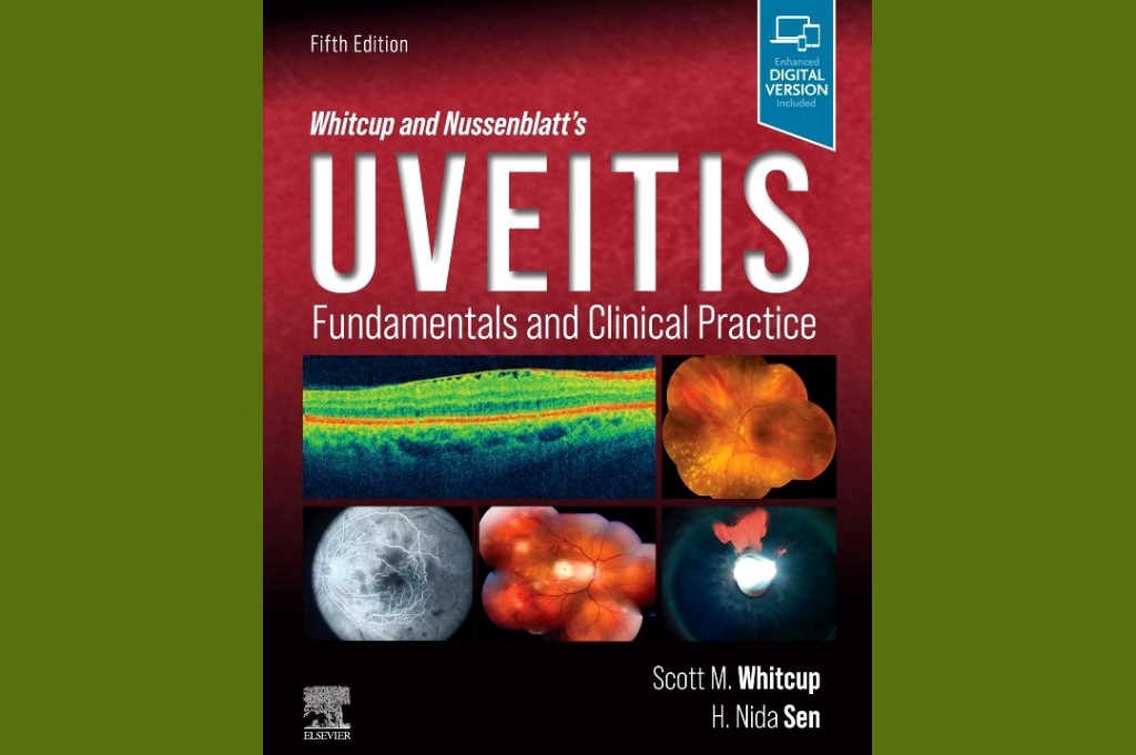 BOOK REVIEW: Whitcup and Nussenblatt's Uveitis 5th edition by Scott M ...