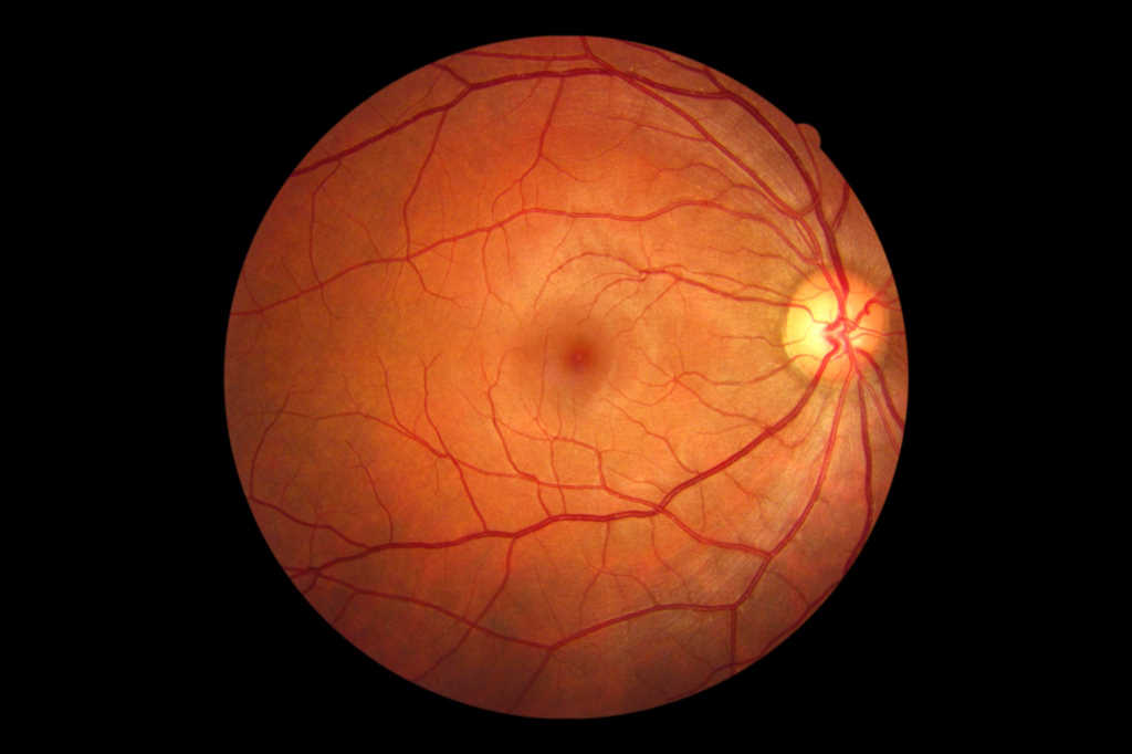 Retina research update